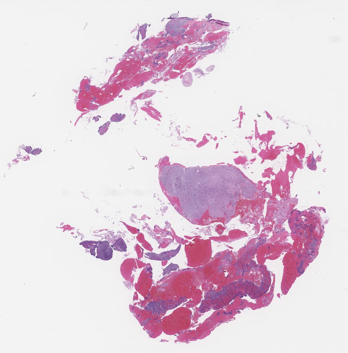 Rush Pathology Il Registry Of Ap Case 5 Kiko Xp